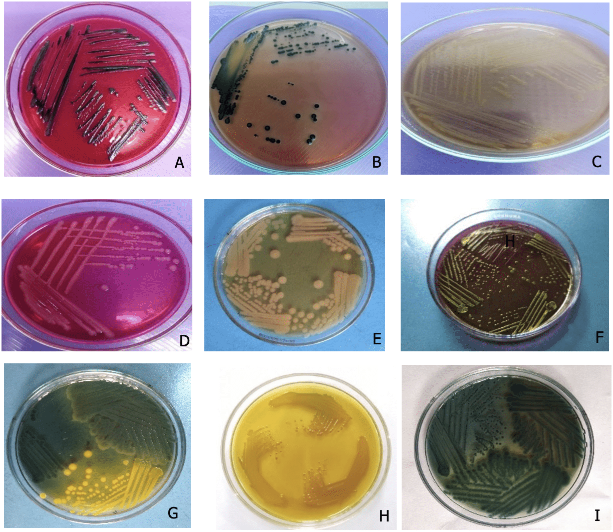 Isolation And Identification Of Enteric Bacteria From Different Water ...